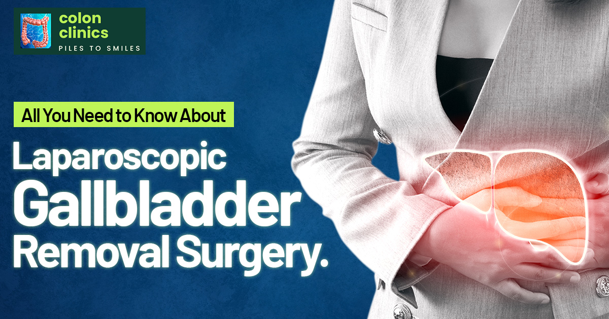 Best Laparoscopic Gallbladder Removal Surgery In Visakhapatnam : Dr ...